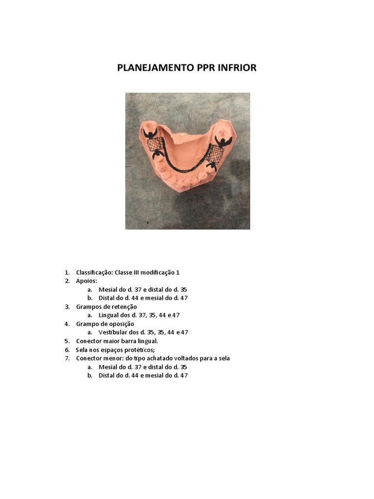 Planejamento PPR Inferior Classe III Modificação 1 | PDF