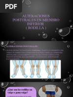 Ejercicios para Rodillas Valgas, Como Enderezar Piernas, Rodilla en X ...