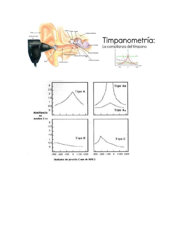 Curvas de Jerger | PDF | Oído | Escuchando