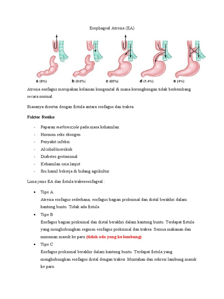 Atresia Esofagus | PDF | Kajian Bahasa Asing | Kesehatan Holistik