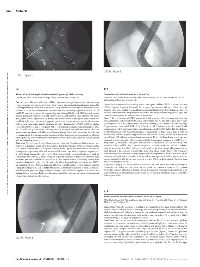 Biloma A Rare, Late Complication of Incomplete.173 | PDF | Gallbladder ...