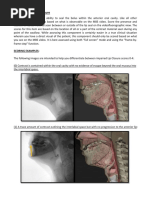 Drooling Severity and Frequency Scale (DSFS) | PDF
