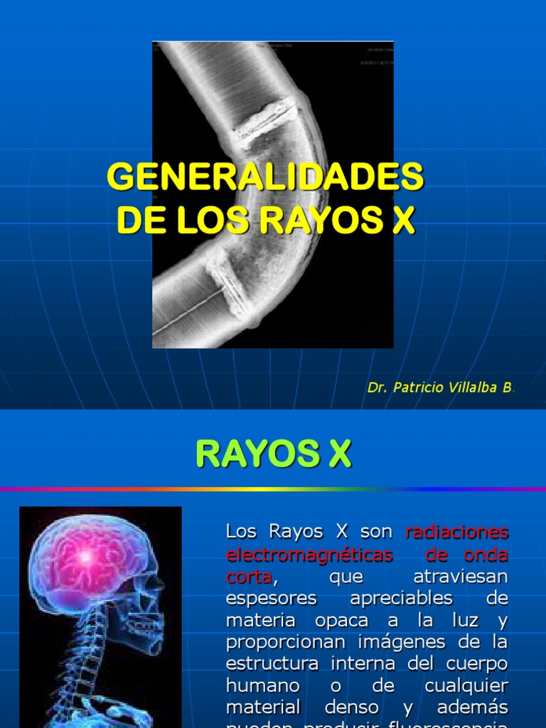 Generalidades de los Rayos X | PDF | Rayo X | Electrón