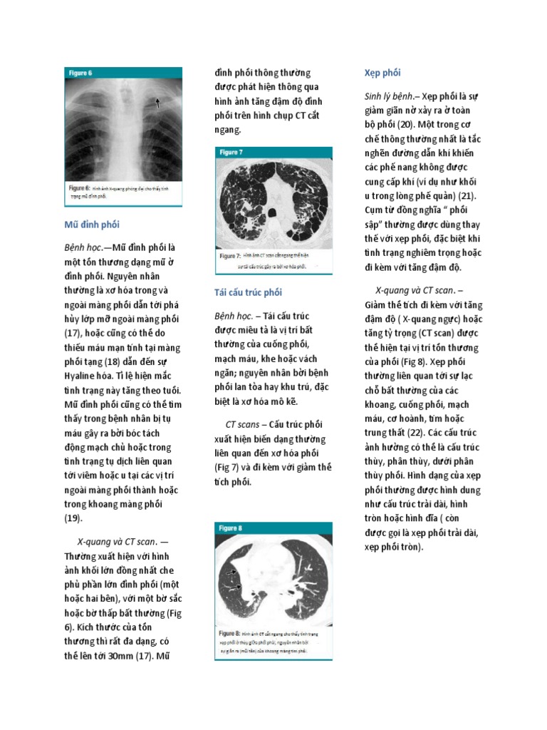 Fleischner Society Glossary of Terms For Thoracic Imaging Dich | PDF