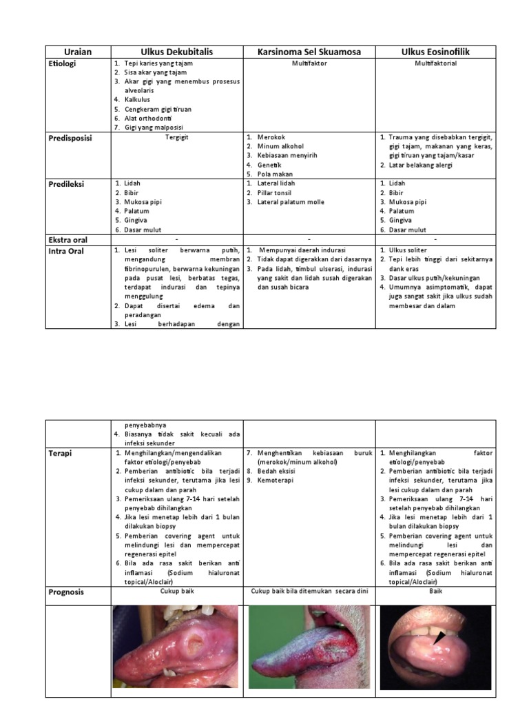 Ulkus dan Karsinoma Oral | PDF