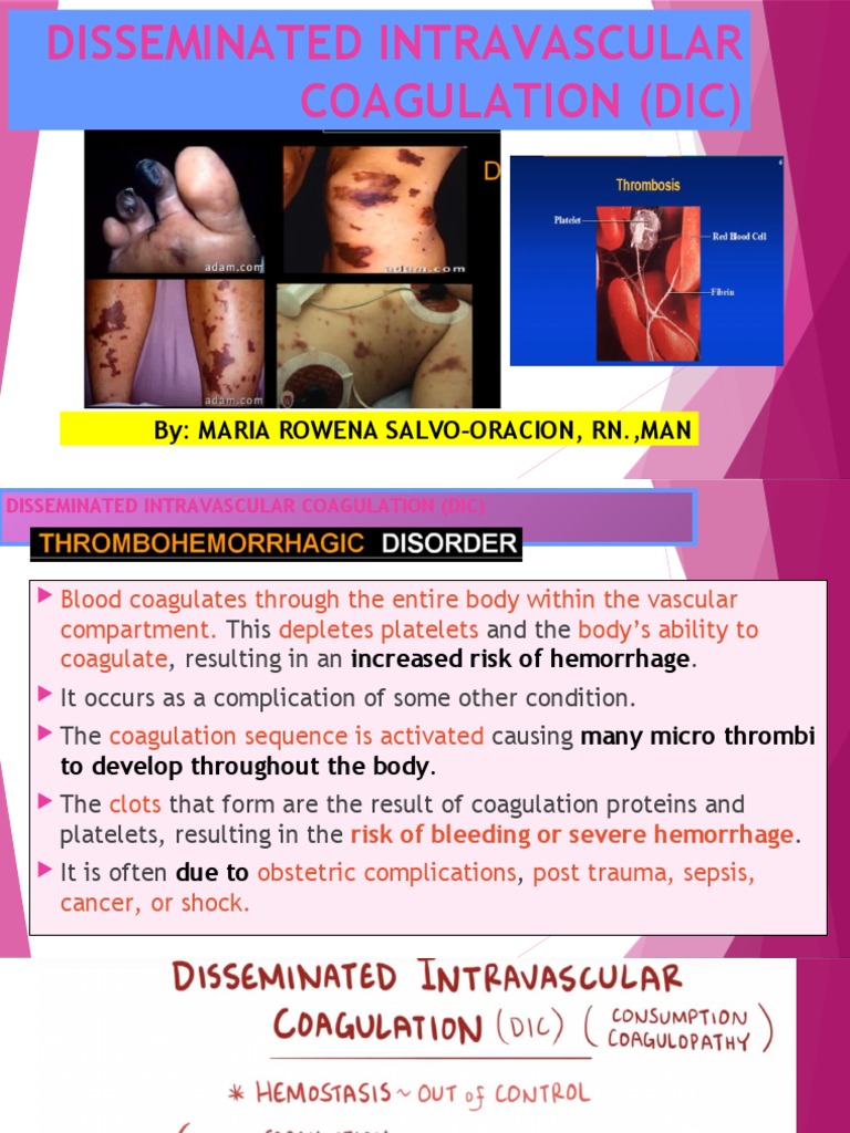 Disseminated Intravascular Coagulation (Dic) | PDF