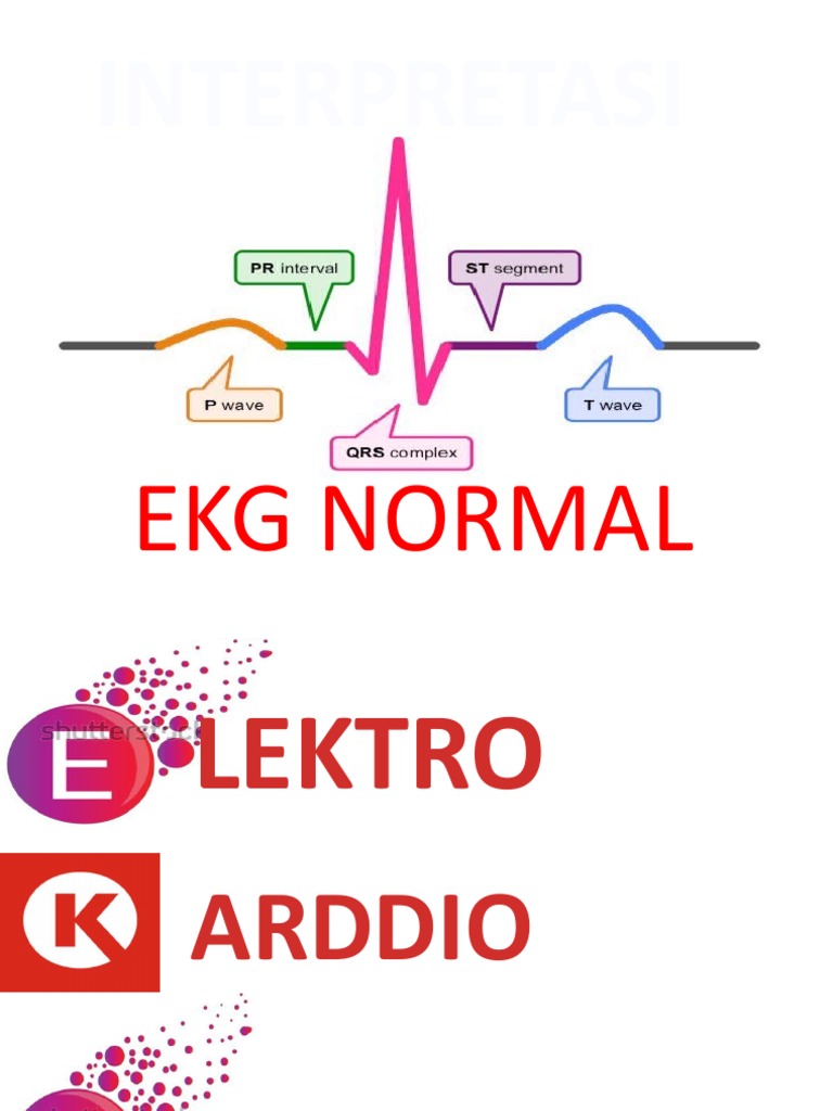 Ekg Normal | PDF