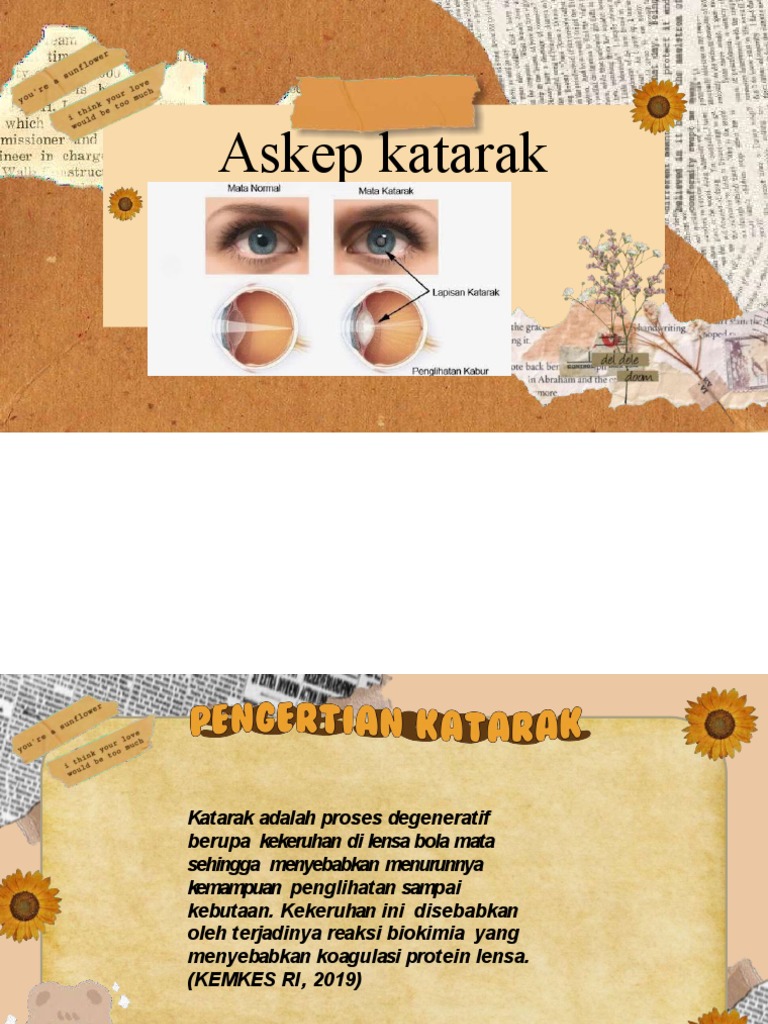 Katarak | PDF