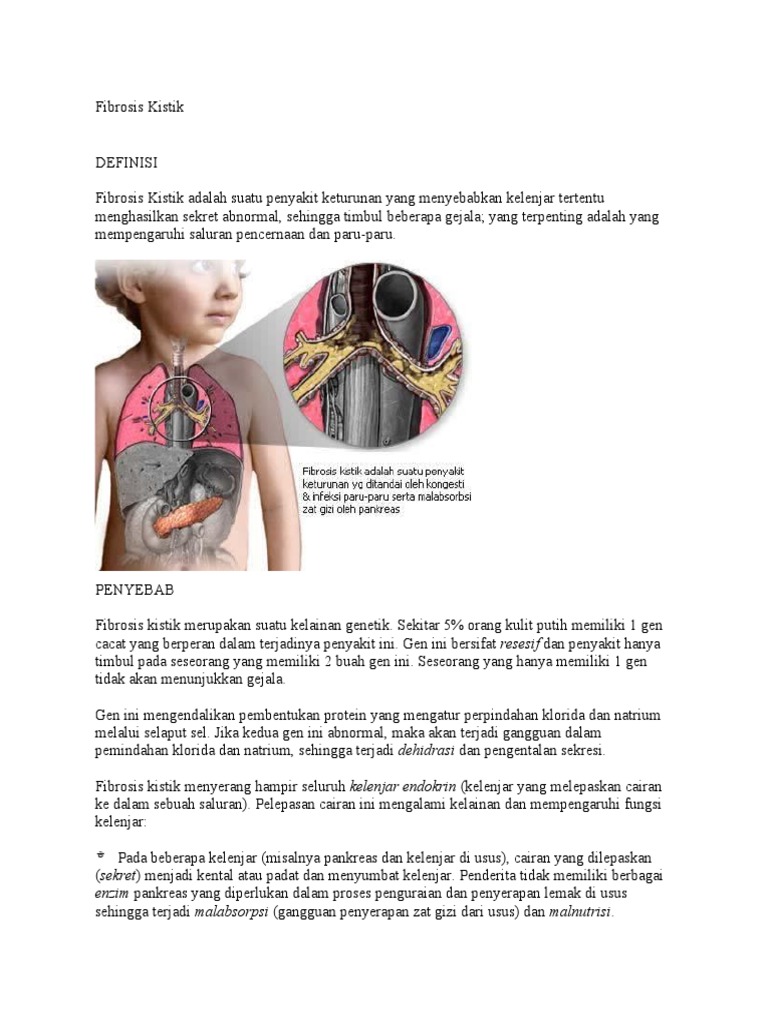Panduan Lengkap Fibrosis Kistik | PDF | Kesehatan Holistik