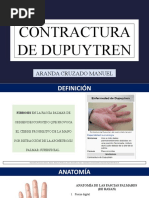 Manejo de la Mano en Garra | PDF | Mano | Extremidades (anatomía)
