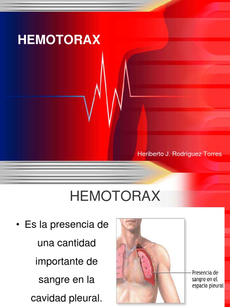 Hemotorax 110419223009 Phpapp02 | PDF