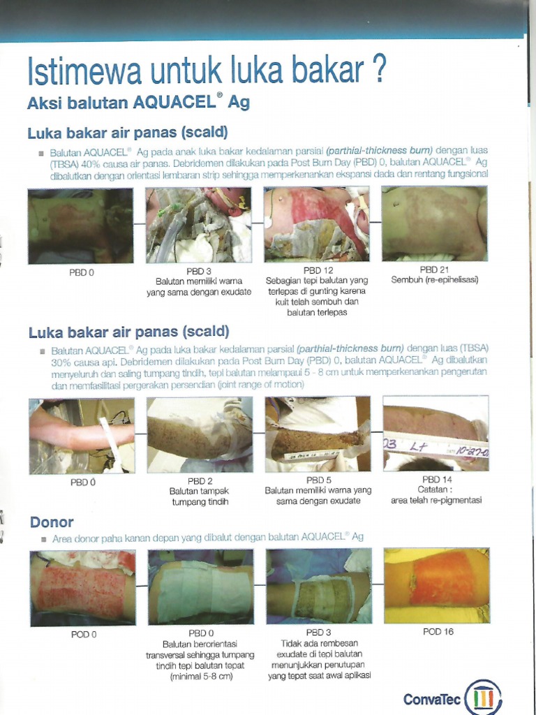 Convatec - Aquacel Ag | PDF