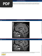 NBME 30 BLOCK 1-4 (Answers Version) | PDF | Foreign Language Studies | Science & Mathematics
