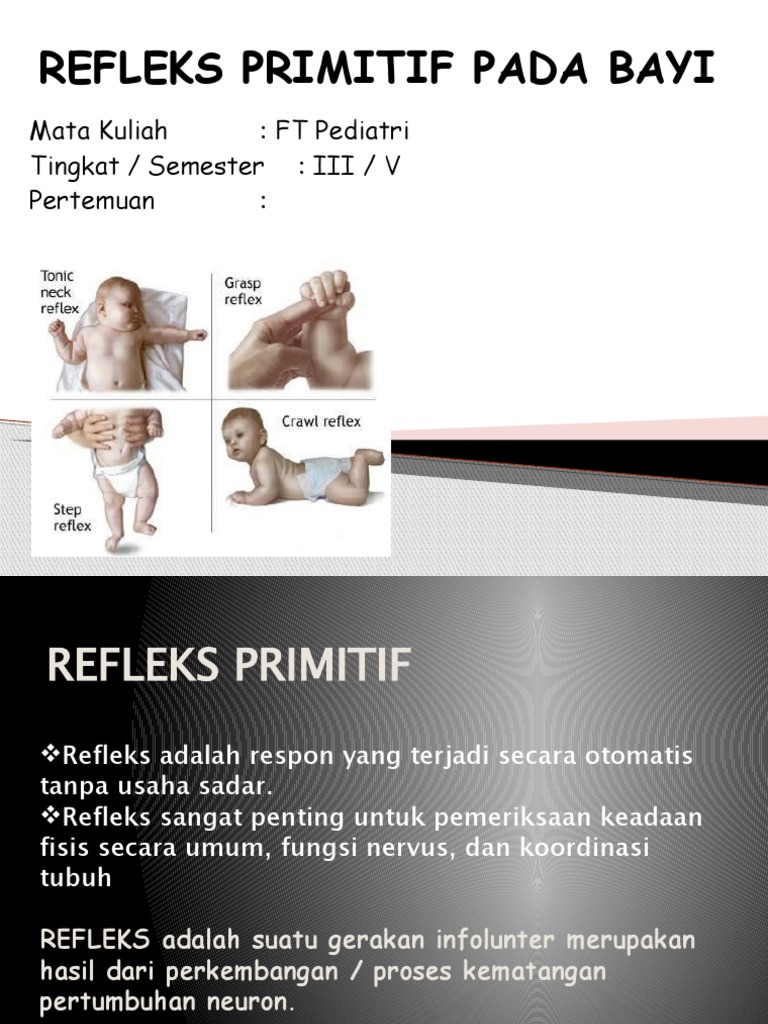 PRIMITIVE REFLEXES IN INFANTS | PDF