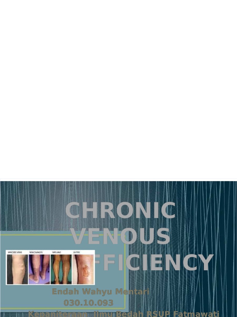 PDF Cvi PPT 2 DL | PDF