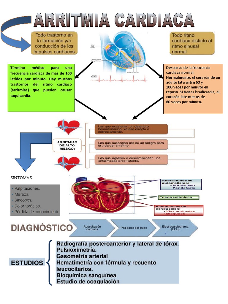 Mapa Mental Arritmia Pdf