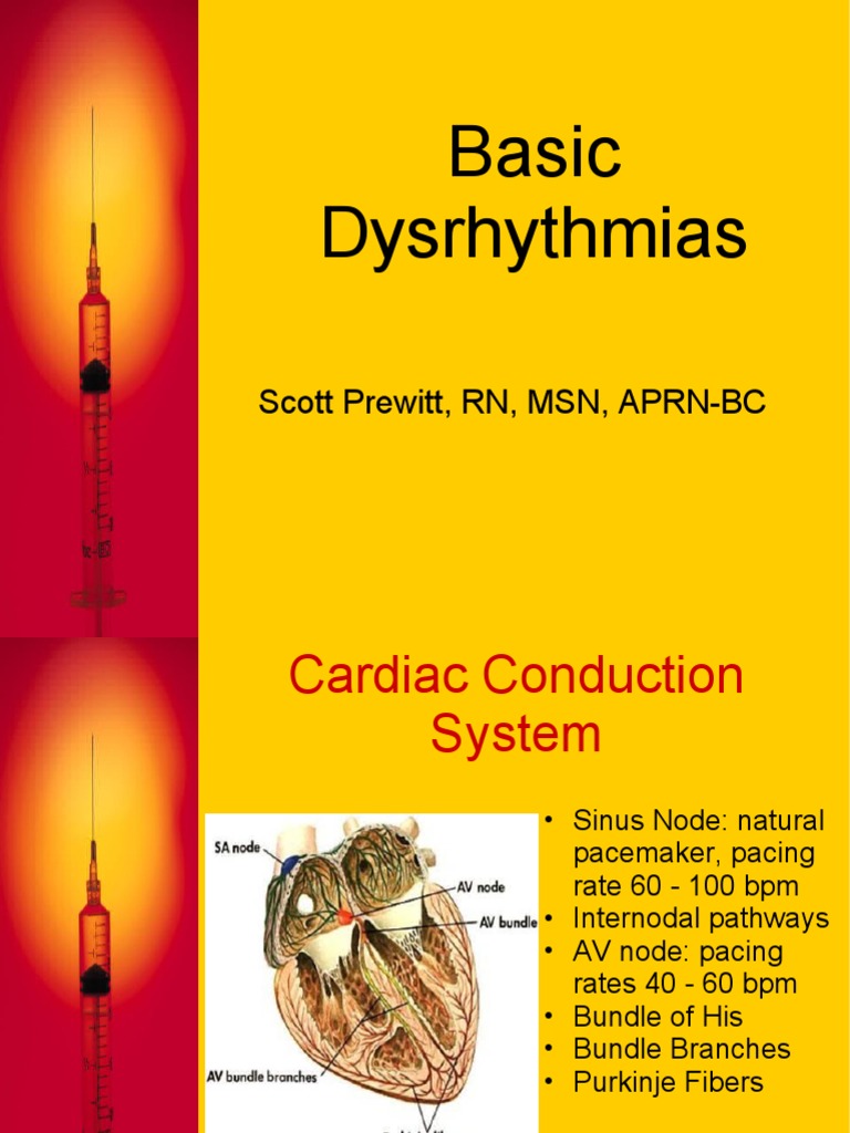 Understanding Cardiac Dysrhythmias | PDF | Cardiovascular System | Heart