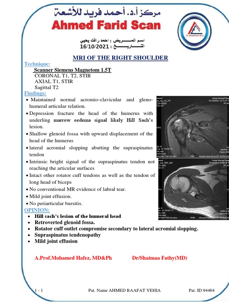 Mri of The Right Shoulder: Technique | PDF | Wellness