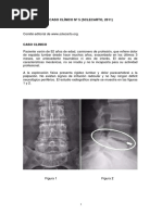 Cambios Modic Qué Son, Tipo y Diagnóstico InfoEspalda | PDF | Cirugía ...