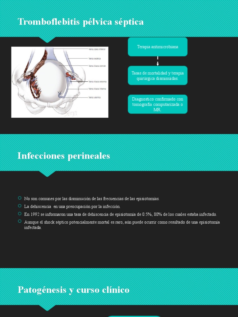 Tromboflebitis Pélvica Séptica | PDF