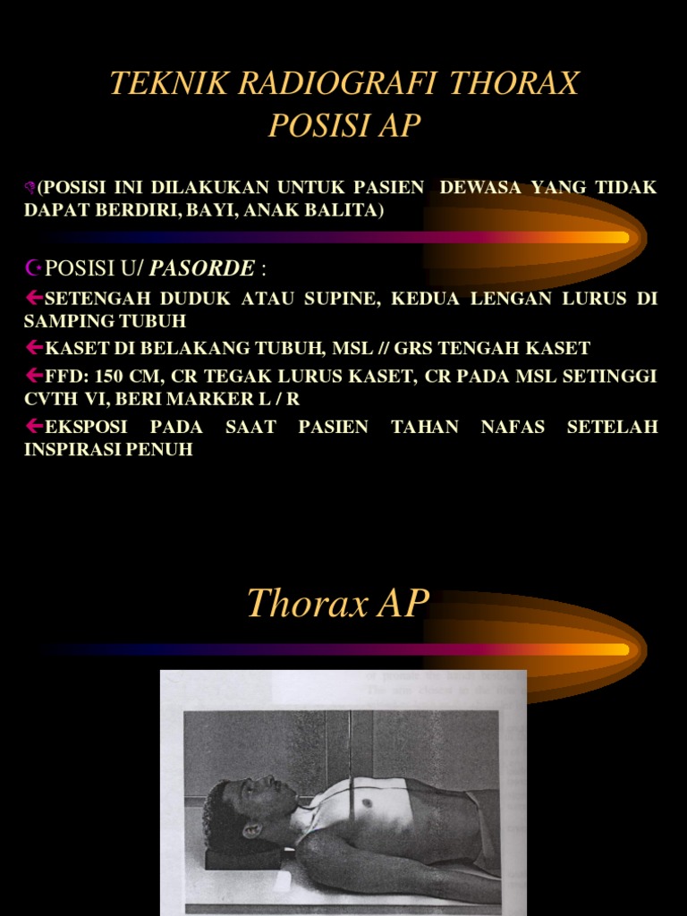 TR Thorax AP | PDF