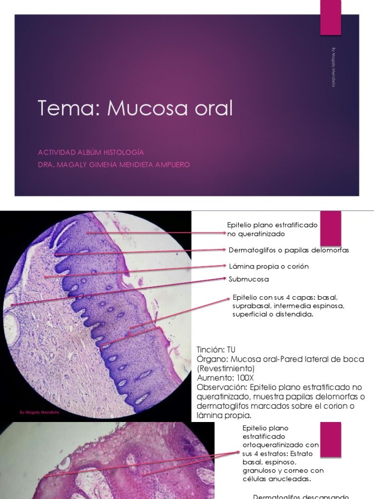 Placas Histológicas Mucosa Oral | PDF | Epitelio | Membrana mucosa