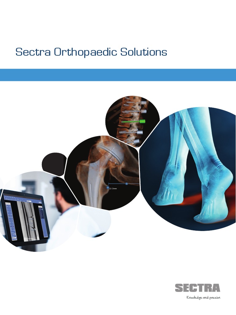 Sectra Orthopaedic Solutions | PDF | Surgery | Calibration