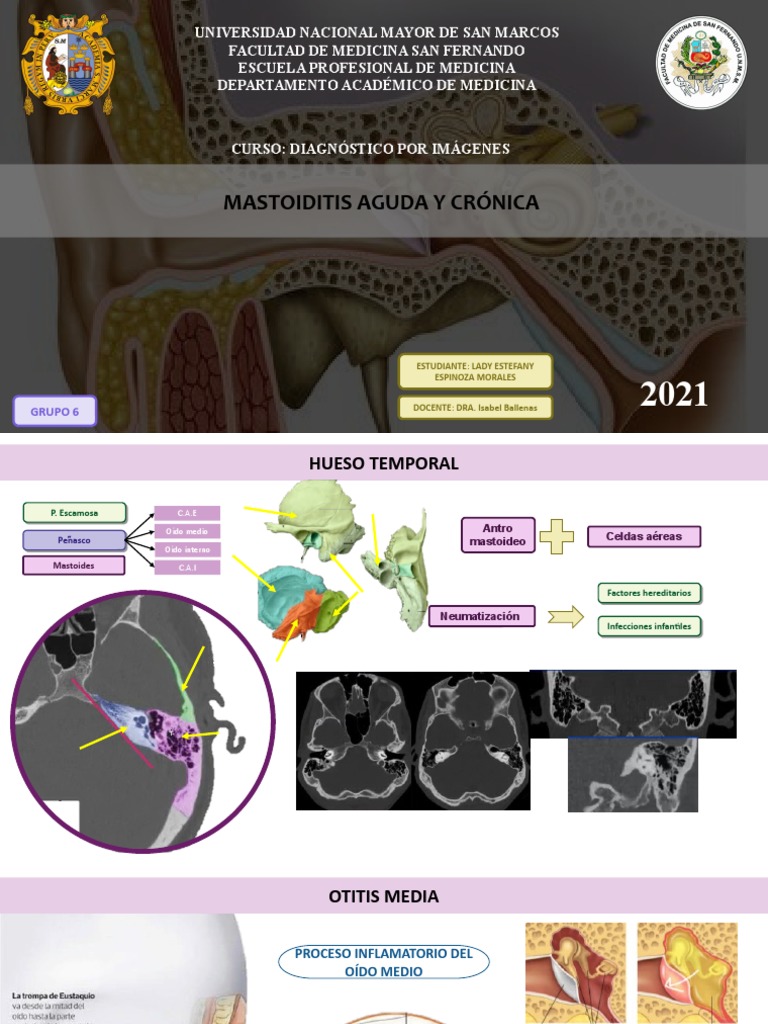 Mastoiditis Aguda y Crónica: Diagnóstico y Síntomas | PDF | Neurología ...