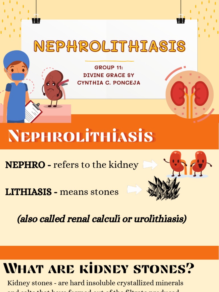 Nephrolithiasis XX | PDF | Kidney | Urinary System