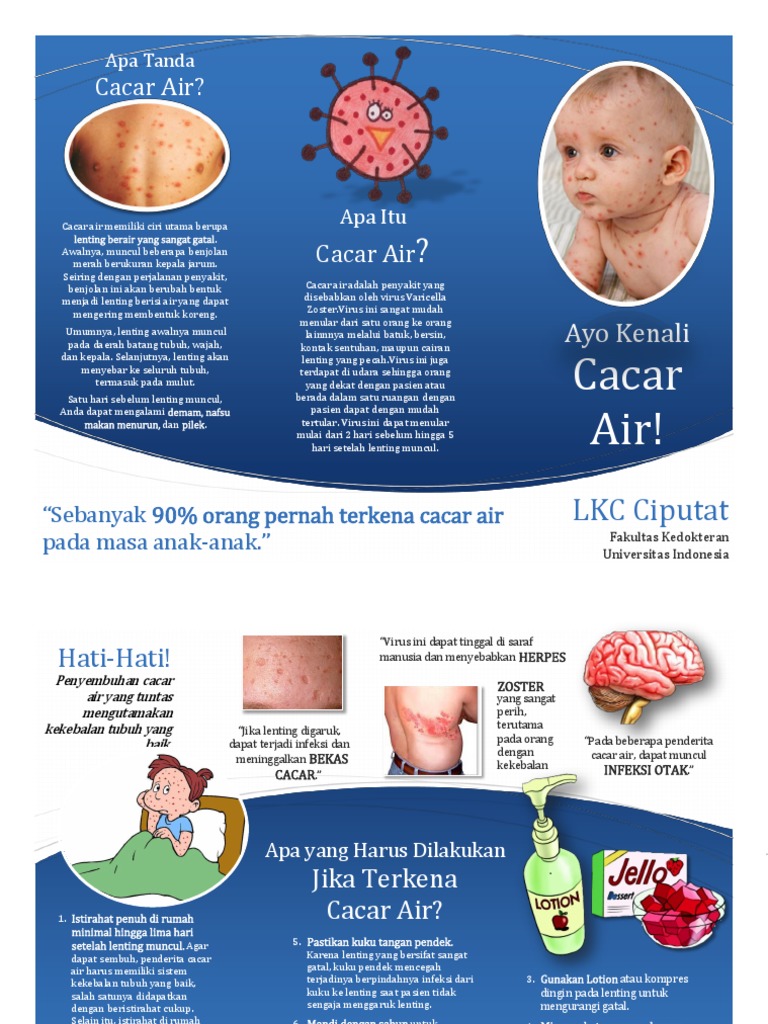 Template Pamflet Cacar Air | PDF