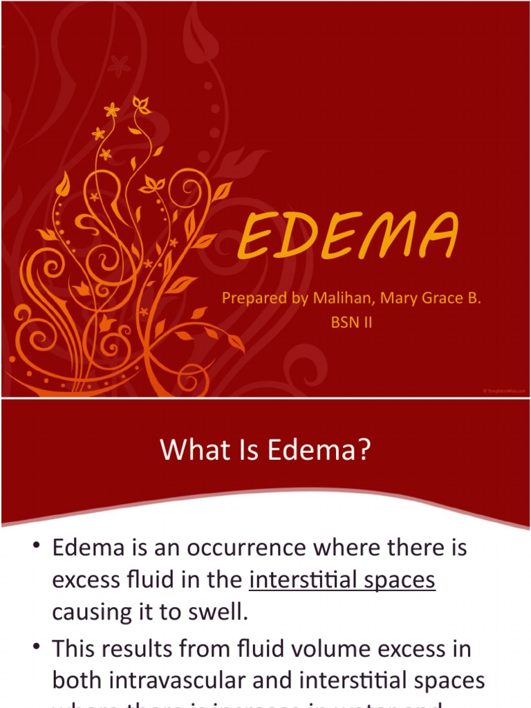 Understanding Edema: Causes & Treatment | PDF | Wellness | Science ...