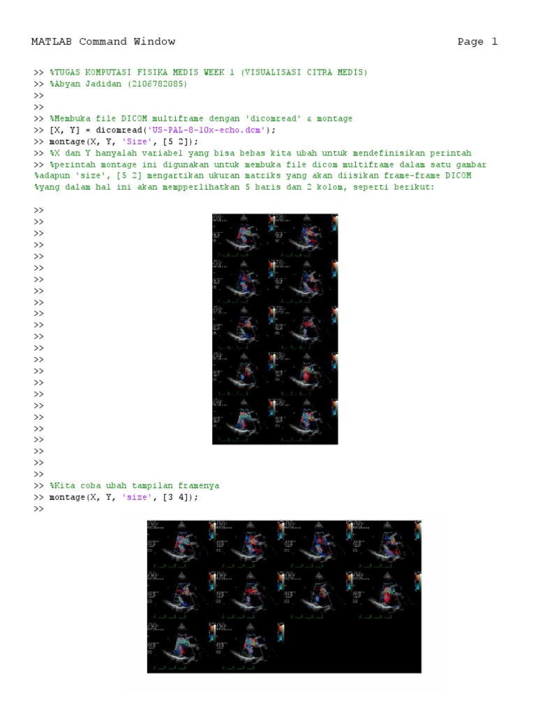 MATLAB Command Window: 'US-PAL-8-10x-echo - DCM' 'Size' | PDF ...