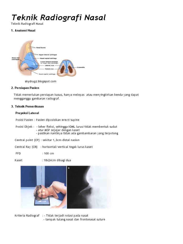 TEKNIK RADIOGRAFI NASAL | PDF