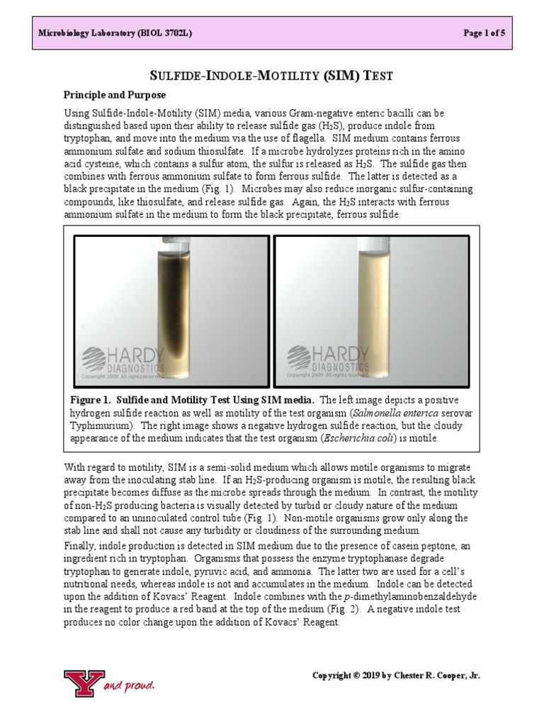 SIM Test | PDF | Salmonella | Microbiology