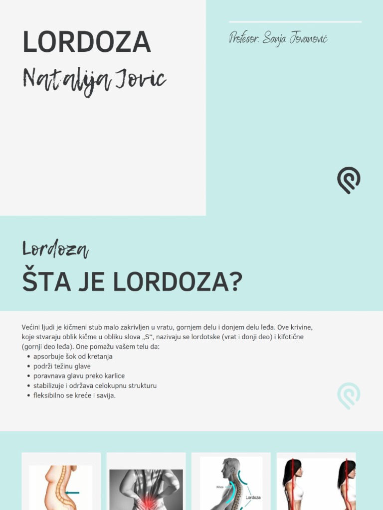 LORDOZA | PDF