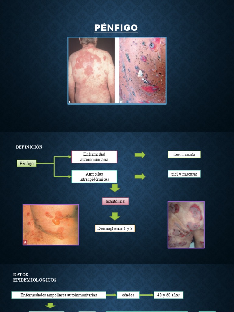 Pénfigo Tipos | PDF | Especialidades Medicas | Medicina CLINICA
