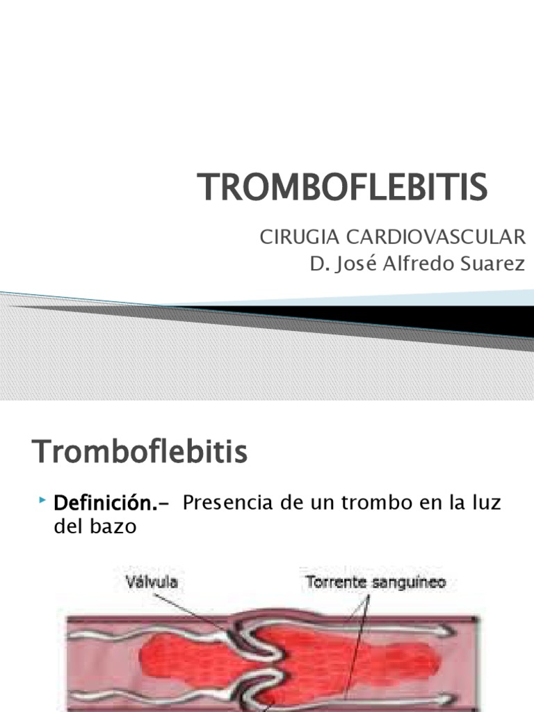 TROMBOFLEBITIS | PDF