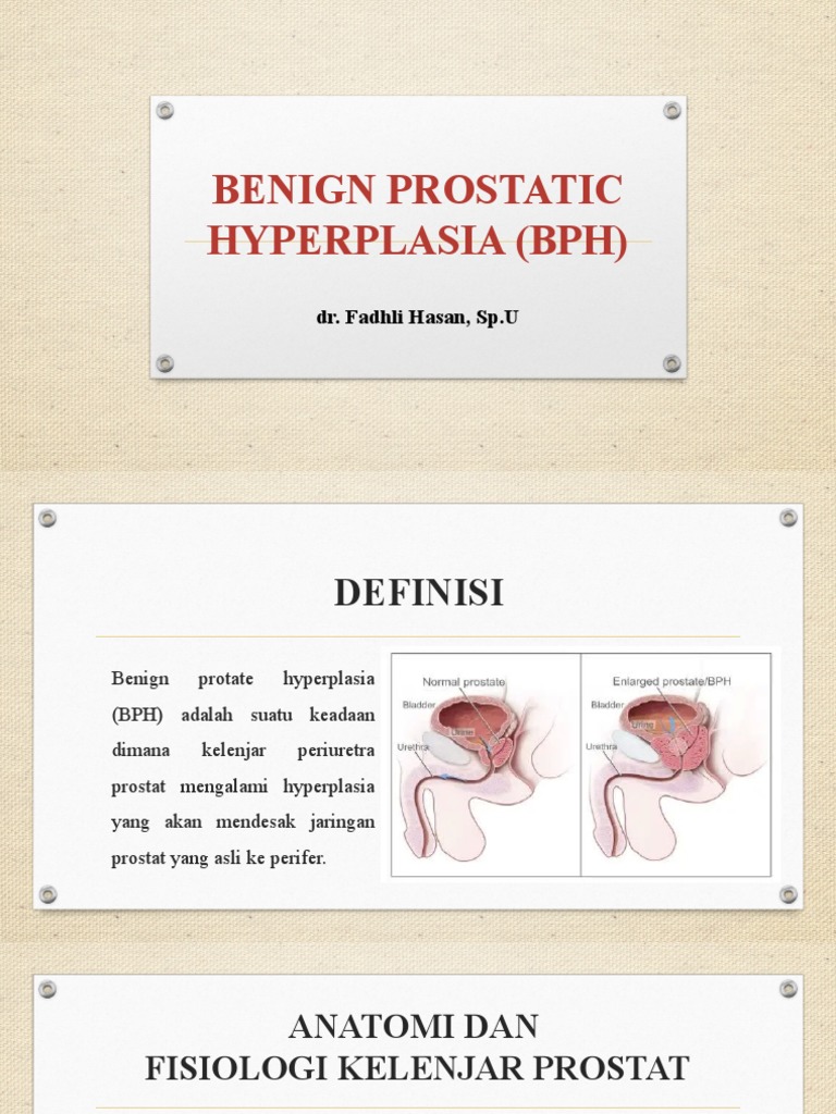 Panduan Lengkap Benign Prostatic Hyperplasia (BPH) | PDF | Pengembangan ...