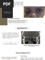 Fractura Lefort: Caso Clínico y Tratamiento | PDF | Enfermedades y ...