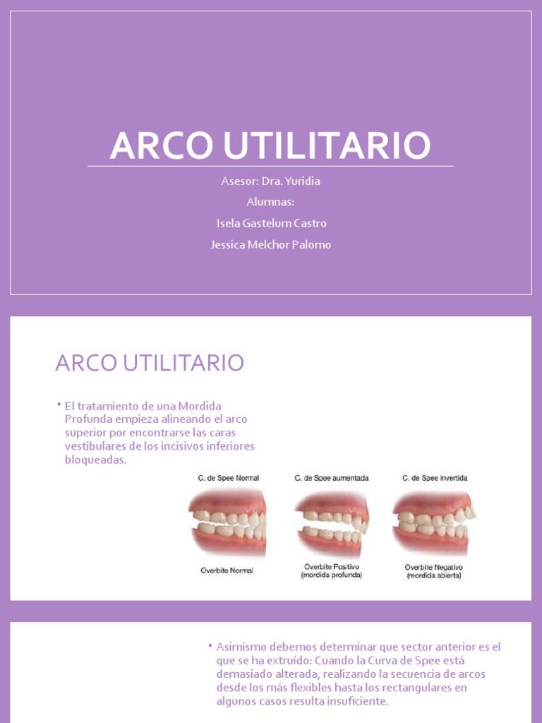 Arco Utilitario | PDF