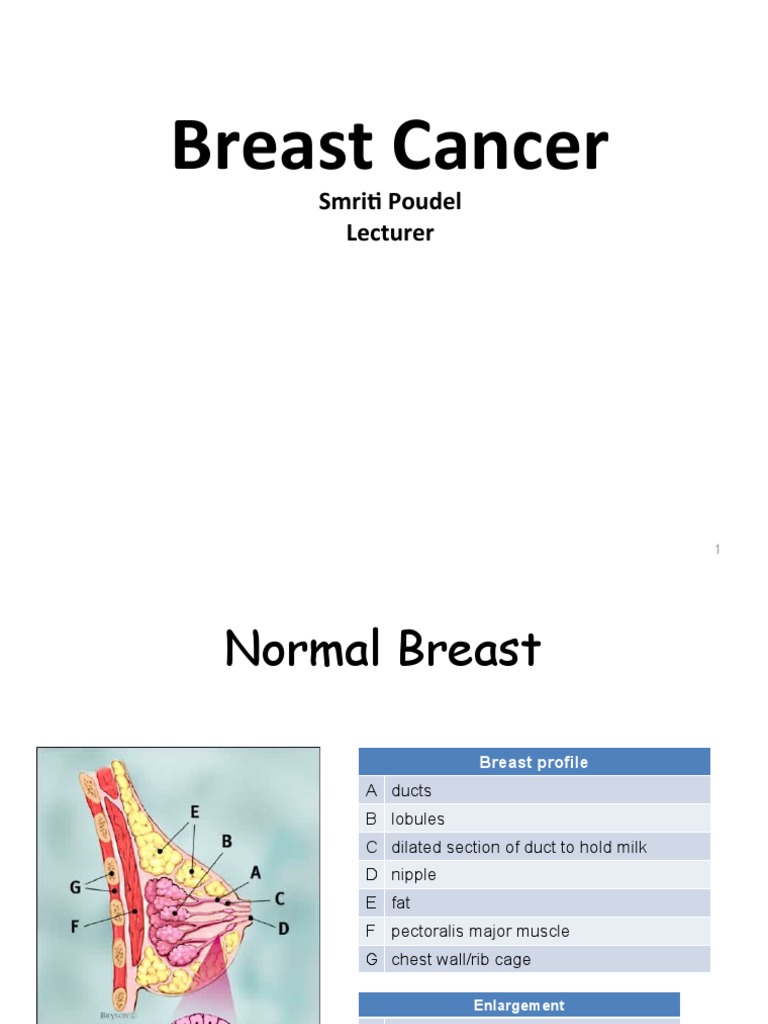 Breast Cancer: Smriti Poudel Lecturer | PDF | Breast Cancer | Cancer