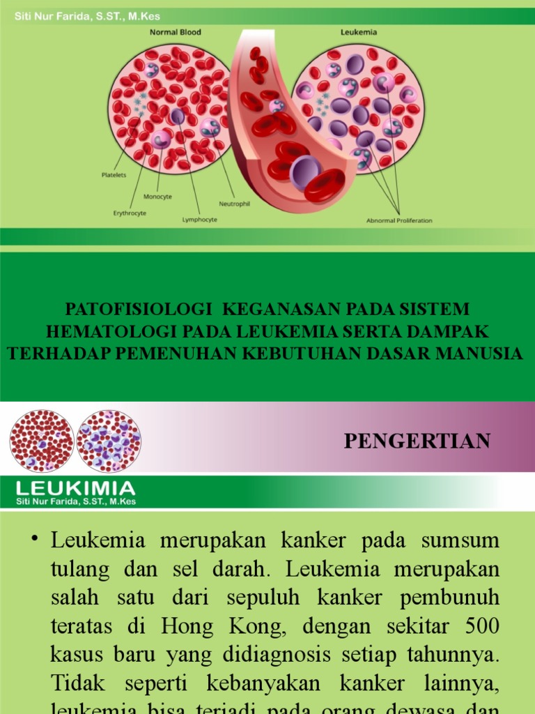Patofisiologi Dan Diagnosis, Kelainan Hemostasis Pada Leukemia (Pertemuan 2) | PDF
