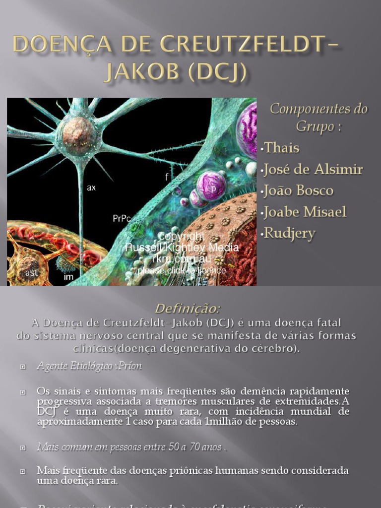 Doena de Creutzfeldt-Jakob (DCJ) | PDF | Epidemiologia | Ciências da Saúde