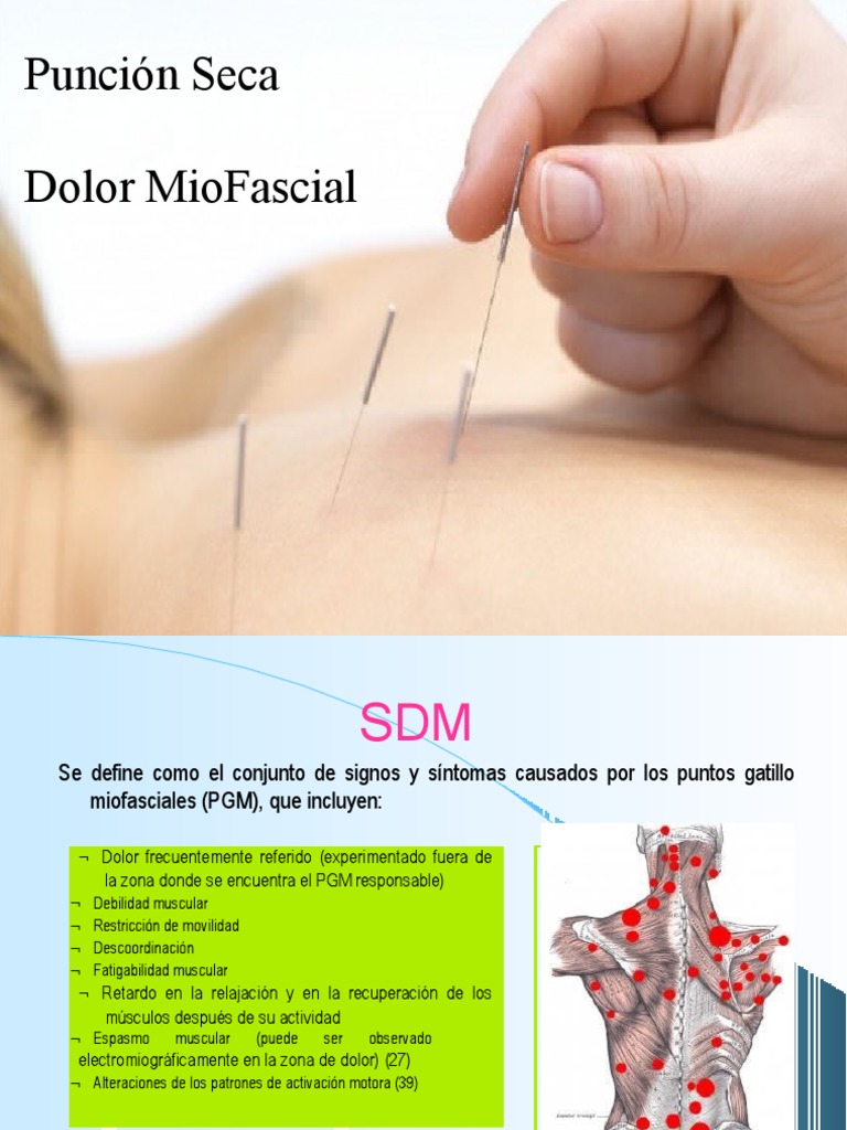 Punción Seca | PDF | Punto gatillo miofascial | Enfermedades y trastornos