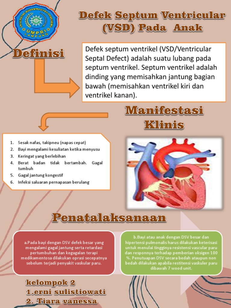 Defek Septum Ventricular (VSD) Pada Anak | PDF