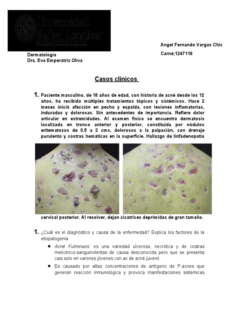 Casos Clinicos Dermatologia | PDF