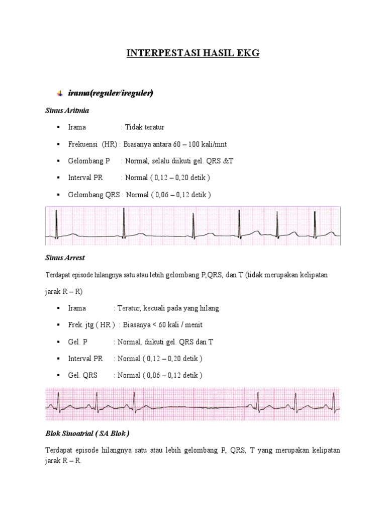 Interprestasi Hasil Ekg | PDF
