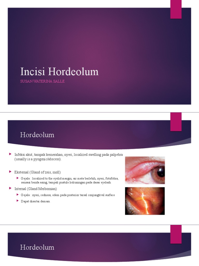 Incisi & Kuretase Hordeolum | PDF
