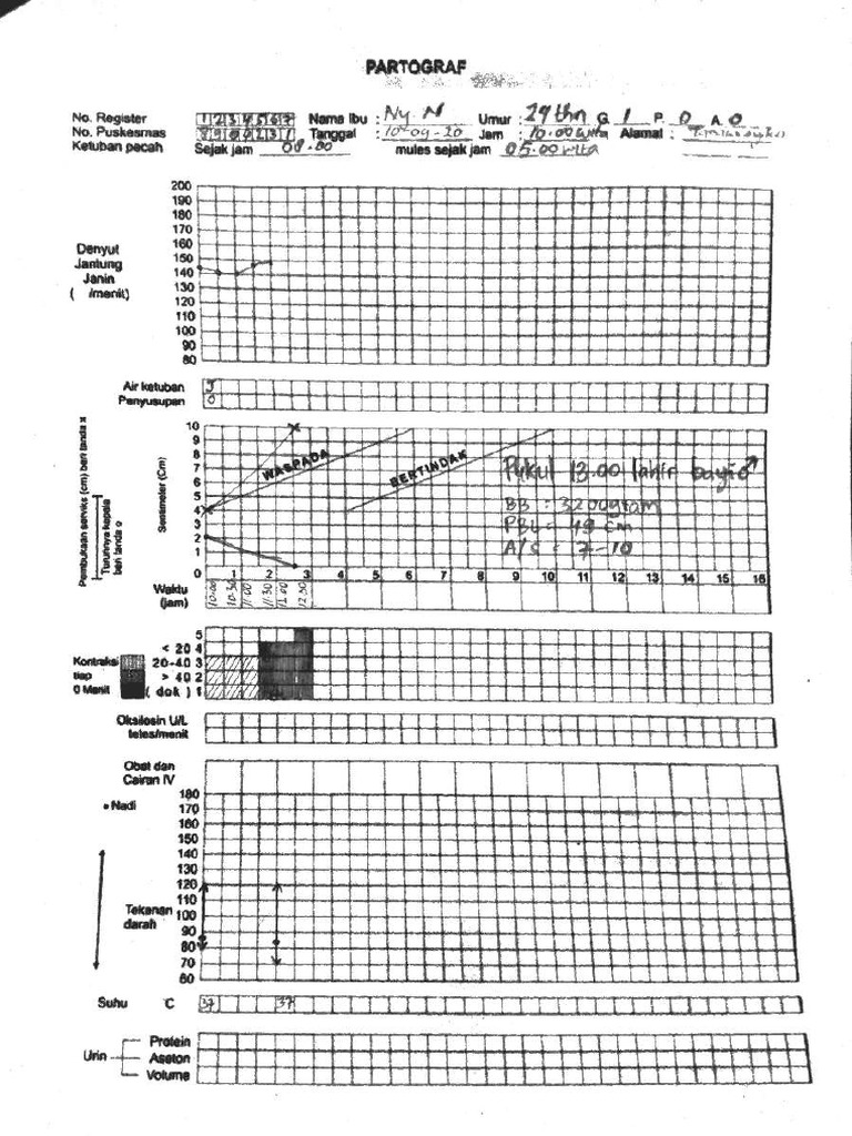 Kasus Persalinan Dan Partograf | PDF