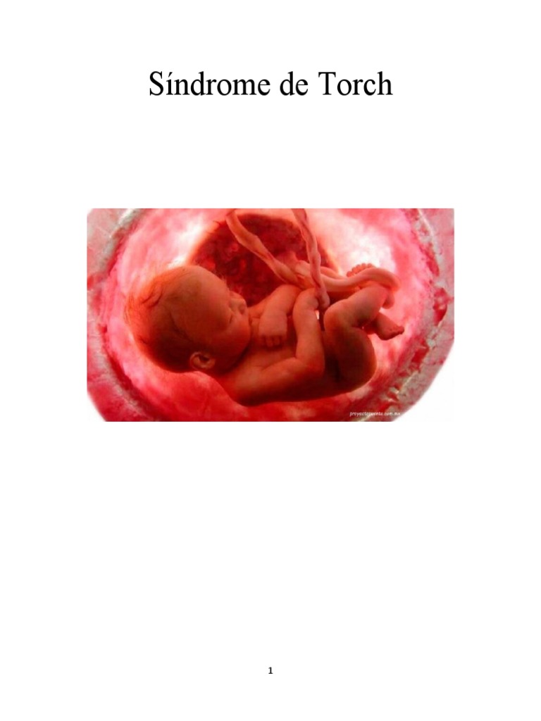 Síndrome de Torch | PDF | Herpes Simple | El embarazo